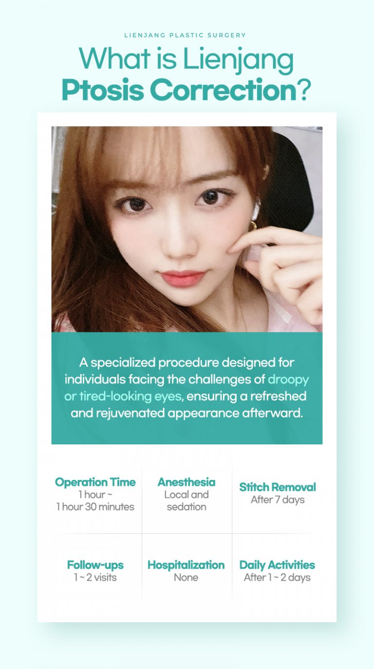 Ptosis Correction – Lienjang Plastic Surgery Dermatology Korea