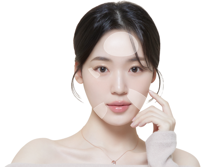 Ultrasound-Guided Thread Lifting - Lienjang Clinic Korea